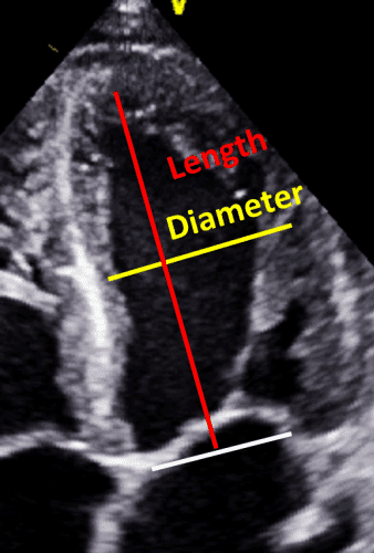 LV EF (area length-method) - Dr. Ghazal